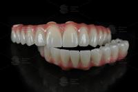China Dental Lab Shenzhen Specializing In Custom Dental Prosthetics Crowns Bridges Implants And Orthodontic Appliances For Dental Practices for sale
