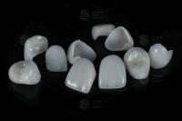 China 0.3mm-0.7mm Feldspathic EMAX Ceramic Veneers Natural Aesthetic Emax Dental Veneers for sale