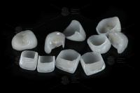 China 0.3mm-0.7mm Feldspathic EMAX Ceramic Veneers Natural Aesthetic Emax Dental Veneers for sale