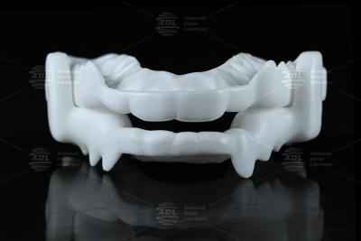 China Medical-grade Nylon Occlusal Splint Night Guard with Flexible CAD/CAM Design for Bruxism Protection for sale