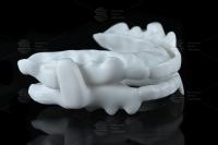 China Medical-grade Nylon Occlusal Splint Night Guard with Flexible CAD/CAM Design for Bruxism Protection for sale