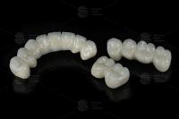 China Precise Fit High Esthetic Precious Alloy PFM Crown Porcelain Fused To Metal Crown for Dental Lab for sale