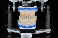 China Precise Fit High Esthetic Precious Alloy PFM Crown Porcelain Fused To Metal Crown for Dental Lab for sale
