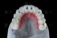 China High Translucency Layered Zirconia Crown And Bridge With Natural Esthetics And Precise Fit For Dental Lab Restorations for sale