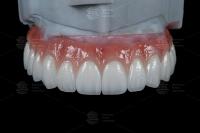 China High Translucency Layered Zirconia Crown And Bridge With Natural Esthetics And Precise Fit For Dental Lab Restorations for sale