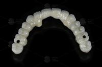 China Natural Looking PFM Implant  Bridge with Precise Fit and Co Cr Alloy Framework for Porcelain Fused To Metal Crown And Bridge Restorations for sale