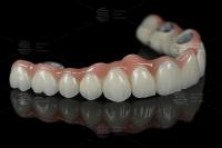 China Natural Looking PFM Implant  Bridge with Precise Fit and Co Cr Alloy Framework for Porcelain Fused To Metal Crown And Bridge Restorations for sale