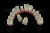 China China Dental Lab Malo Zirconia Bridge Implant Supported Screw Retained Full Arch Restoration for sale