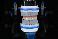 China China Dental Lab Malo Zirconia Bridge Implant Supported Screw Retained Full Arch Restoration for sale