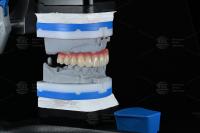 China China Dental Lab Malo Zirconia Bridge Implant Supported Screw Retained Full Arch Restoration for sale