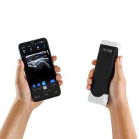 China Portable Handheld Wireless Ultrasound Scanner 2-15MHz 128 Elements for sale