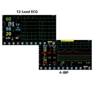 China Portable Anesthesia Monitor 15.6 Inch TFT LCD Touch Screen Oxygen Analyzer Veterinary for sale