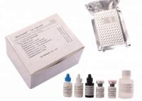 China Tumor Marker ELISA Reagent Kit AFP PSA CEA CA125 CA153 FERRITIN 96 Wells for sale