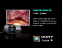 China Full HD 2.4 Megapixel Laparoscopy Endoscopy Camera with In-Built Recorder for Urology Surgery for sale