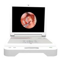 China Gynecology ENT Portable Endoscope Camera 17