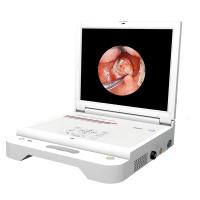 China Gynecology ENT Portable Endoscope Camera 17