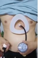 China Pectus Excavatum Brace Funnel Chest Brace breast corrector for sale