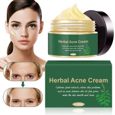 China Organic Herbal Anti Acne Remover Pimple Treatment Repair Scar Cream for sale