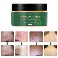 China Organic Herbal Anti Acne Remover Pimple Treatment Repair Scar Cream for sale