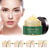 China Organic Herbal Anti Acne Remover Pimple Treatment Repair Scar Cream for sale