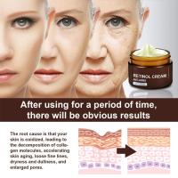 China Whitening Bright Face Cream Anti Aging Remove Wrinkles Hyaluronic Acid Eye Cream for sale