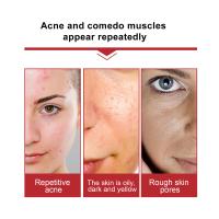 China Moisturizing Repairing Face Serum Soothing Face Serum Complex Fruit Acid Essence for sale
