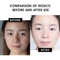 China Skincare Face Serum Hydrating Vitamin C Serum Wrinkle Firming Skin OEM ODM for sale