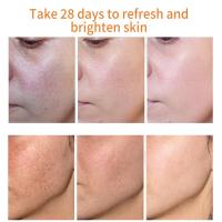 China OEM Facial Moisturizing Cream Brightening Anti Wrinkle Spot Removing Cream for sale