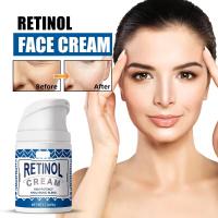 China Face Retinol Night Cream Removal Wrinkle Firming Skin Care Retinol Scar Removal Cream for sale