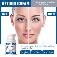 China Face Retinol Night Cream Removal Wrinkle Firming Skin Care Retinol Scar Removal Cream for sale