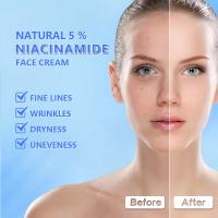 China Nicotinamide Organic Face Cream Arbutin Night Bleaching Skin Lightening Cream For Dark Skin for sale