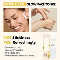 China Witch Hazel Face Toner Pore Minimizer Calming Skin Treatment Product Skin Toner for sale