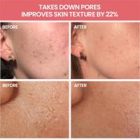 China Witch Hazel Face Toner Pore Minimizer Calming Skin Treatment Product Skin Toner for sale