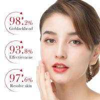 China Whitening Salicylic Acid Essence Serum Beauty Facial Serum Acne Removal For Body for sale