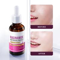 China ODM OEM  Beauty Essence Liquid Moisturizing Serum Nicotinamide Remove Freckle Whitening for sale