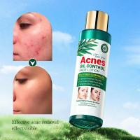 China OEM ODM Face Lotion Natural Organic Tea Tree Moisturizer Aging Skin Treatments for sale