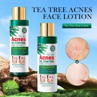 China OEM ODM Face Lotion Natural Organic Tea Tree Moisturizer Aging Skin Treatments for sale