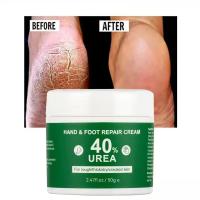 China OEM Vitamin E Hand Foot Care Anti Drying Vaseline Urea Cream Foot Repair for sale