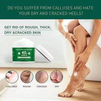 China OEM Vitamin E Hand Foot Care Anti Drying Vaseline Urea Cream Foot Repair for sale