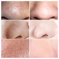 China Blackhead Remover Face Serum Natural Organic Anti Aging Repair Skin Care Serum for sale