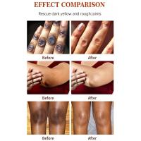 China Face Black Freckle Acne Fade Dark Spot Removing Corrector Whitening Cream for sale
