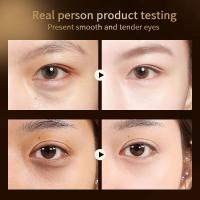 China Firming And Moisturizing Reducing Fine Lines Dark Circles And Bag Removal Eye Dark Circles Remove Cream for sale