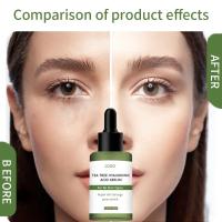 China Tea Tree Sensitive Skin Glow Facial Serum Hyaluronic Acid Serum For Face Whitening for sale