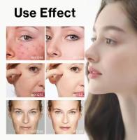 China Hot Selling 7% Glycolic Acid Exfoliating Toner Acne Removal Face Skin Care Toner Private Label Glycolic Exfoliating Toner for sale