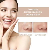 China Face Cream & Lotion Purifying Exfoliating Gel for Dirt Cleaning Pores Shrinking Dredging Skin Blackhead Pimple Remover for sale