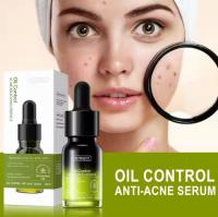 China Customized Logo Face Serum 14 Day Quick Acne Solution Essence 10ml for sale