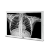 China TKUN 23.8/27 Inch High-definition Medical Display Surgical Display Can be Customized SDI Multiple Interfaces 4K Monitor for sale