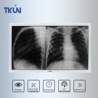 China TKUN 23.8/27 Inch High-definition Medical Display Surgical Display Can be Customized SDI Multiple Interfaces 4K Monitor for sale