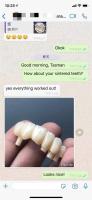 China Yucera  Multilayer Sht Zirconia Dental Block Amann System 89MM /Zirconia Disk for CAD CAM for sale