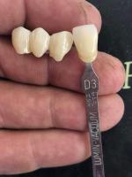 China 3D Plus Multilayer 43% -57% 6 Layers 3D Zirconia Dental Block Disc CAD CAM 89mm System for Dental Lab with ISO CE Certificate for sale